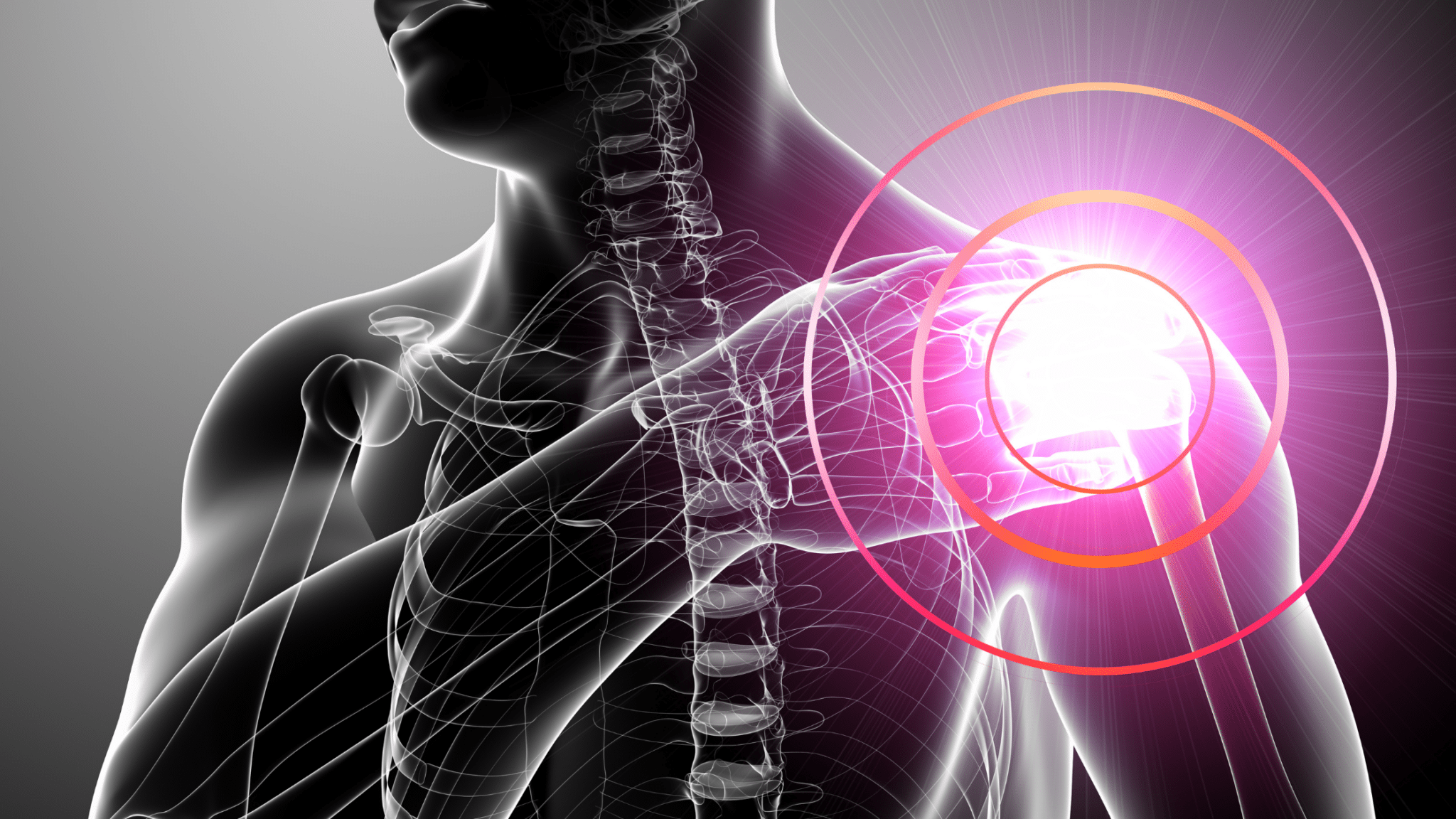 Different Types of Shoulder Surgery: From Procedure to Recovery, Here’s ...